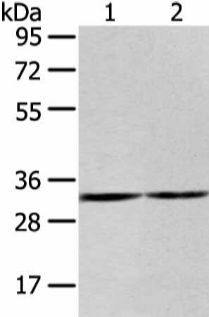 Anti-ZNF146 Antibody (PACO20961) | WB