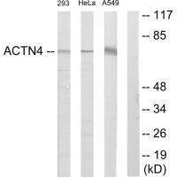 Anti-ACTN1/ACTN2/ACTN3/ACTN4 Antibody (PACO22008) | WB