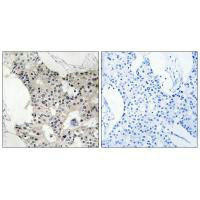 Anti-BAGE4 Antibody (PACO22187) | IHC