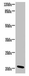 CCDC32 Antibody (PACO41838)