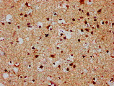 FSD1 Antibody (PACO60324)