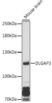 Anti-DLGAP3 Antibody | Suitable for WB | Highly Sensitive