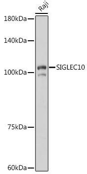 Anti-SIGLEC10 Antibody | Suitable for WB | Highly Sensitive