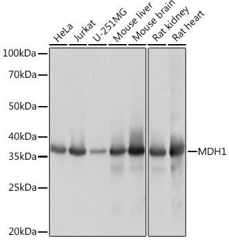Anti-MDH1 Antibody | Suitable for WB | Highly Sensitive