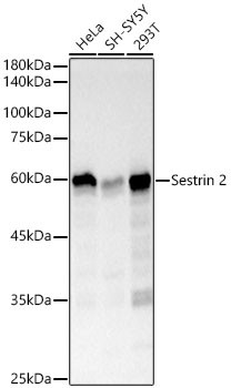 Sestrin 2 Monoclonal Antibody | Assay Genie