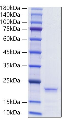 Recombinant Human Ferritin heavy chain/FTH1 Protein (RPCB0755) - Assay ...