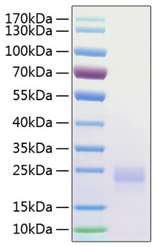 Recombinant Human CTLA-4/CD152 Protein (RPCB0939) - Assay Genie Korea