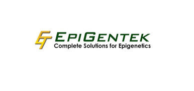 Recombinant SARS-COV-2 S1+S2 ECD(S-ECD) Protein with His tag (Pre ...