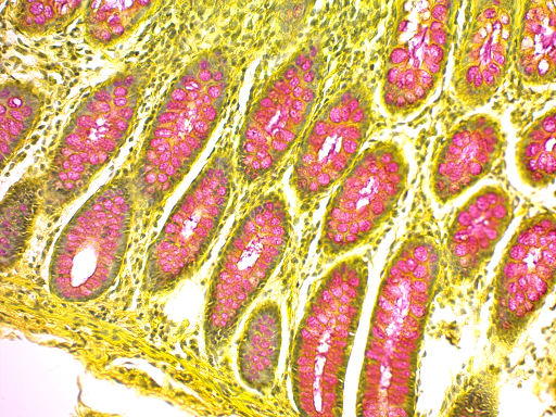 Mucicarmine Microbiology/Histology Stain Kit (Modified Southgate's)