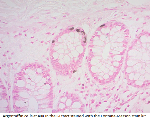 Fontana-Masson Histology Stain Kit (For Argentaffin Cells and Melanin)