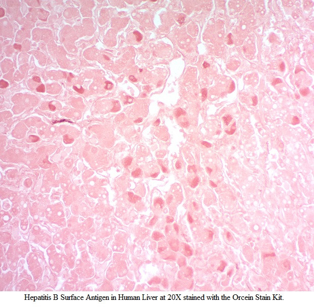 Orcein Microbiology/Histology Stain Kit (For Hepatitis B and Elastic ...