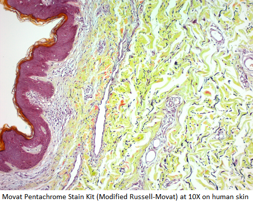 Movat Pentachrome Histology Stain Kit (Modified Russell-Movat)