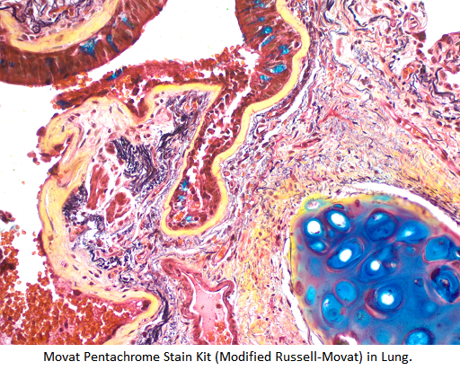 Movat Pentachrome Histology Stain Kit (Modified Russell-Movat)