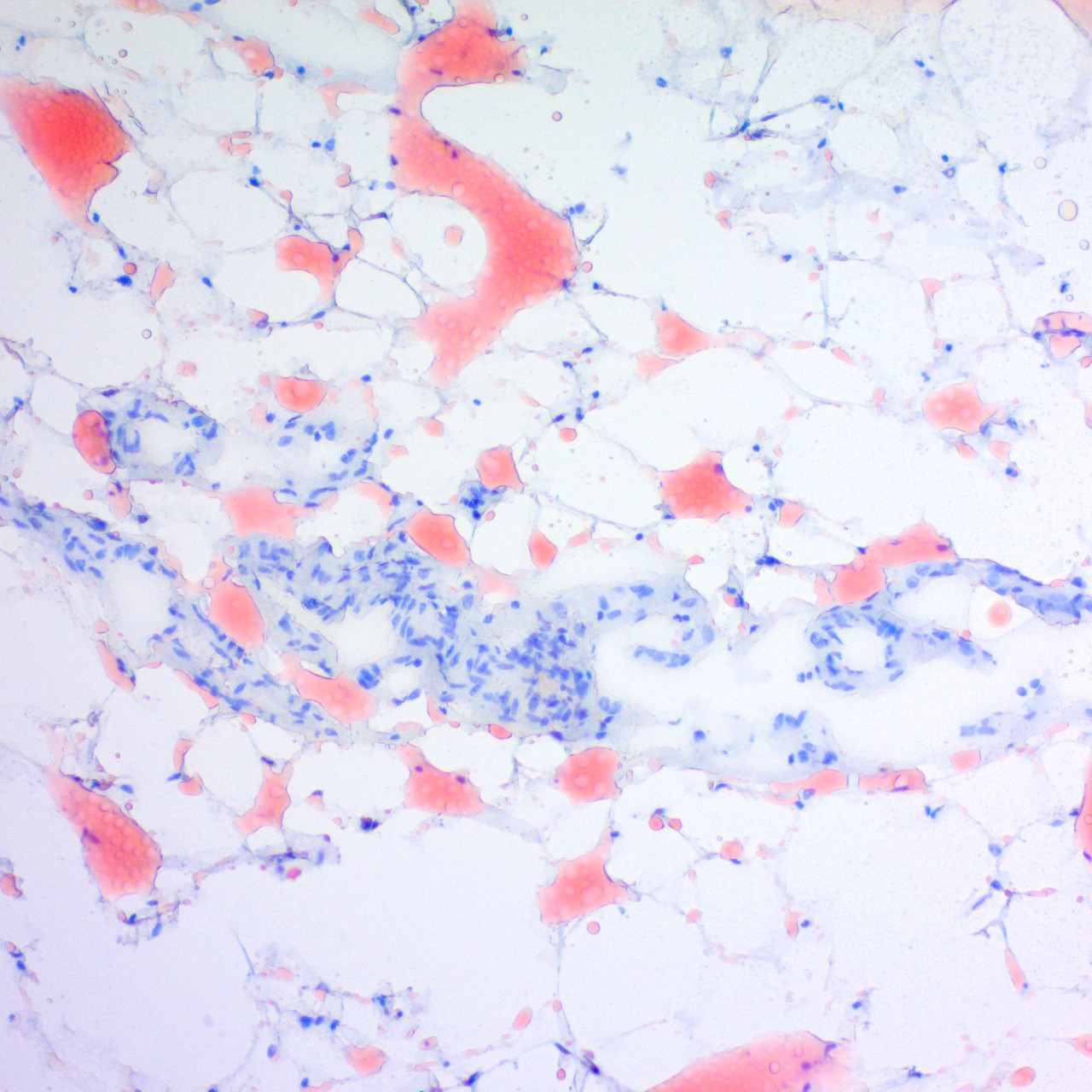 Oil Red O Histology Stain Kit (For Fat), 100 Slides