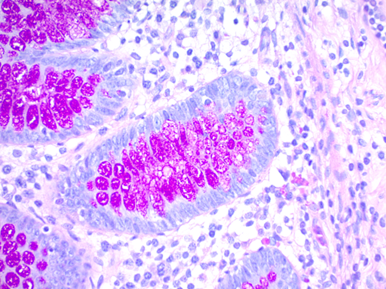 Periodic Acid Schiff (PAS) Histology Stain Kit, 500mL