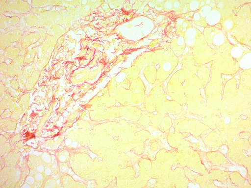 Picro-Sirius Red Histology Stain Kit (For Collagen)