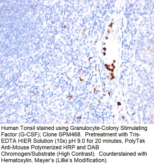 Granulocyte-Colony Stimulating Factor (G-CSF); Clone SPM468 ...
