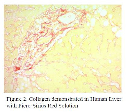 Picro-Sirius Red Solution Histology Stain, 1000mL