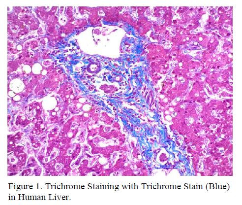 Trichrome Stain (Blue) Histology Stain, 125mL