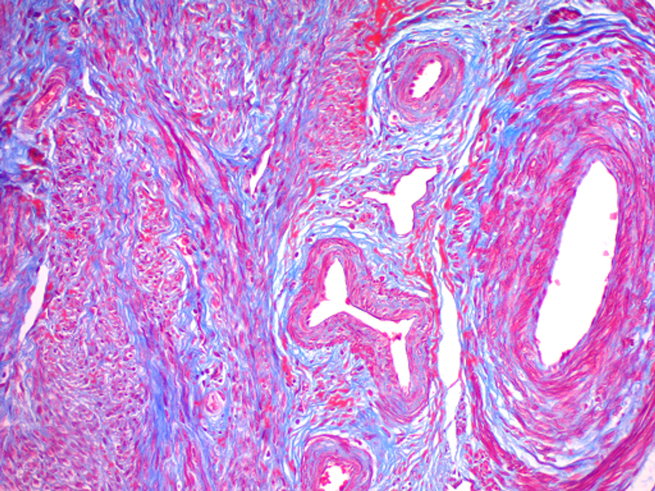 Trichrome Histology Stain Kit Modified Massons 30 Ml