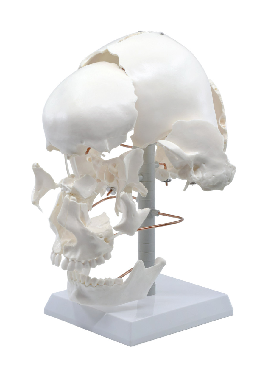 Anatomical Model, Beauchene Exploded Skull, 13 Parts, Life Size ...