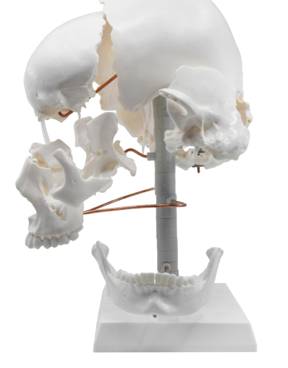 Anatomical Model, Beauchene Exploded Skull, 13 Parts, Life Size ...