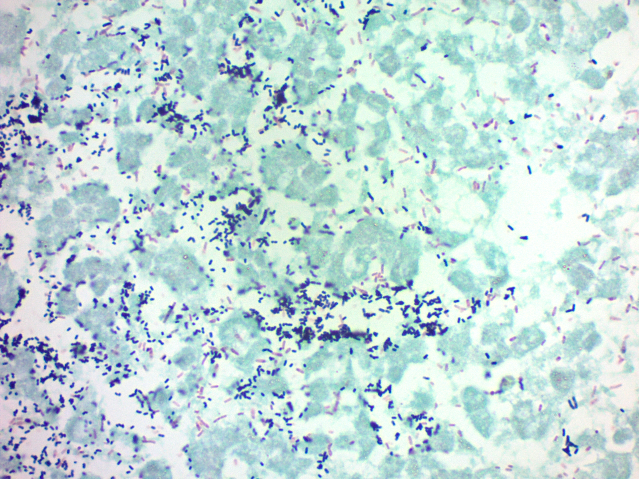 Twort's Gram Microbiology/Histology Stain Kit