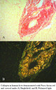 Picro-Sirius Red Histology Stain Kit (For Collagen)