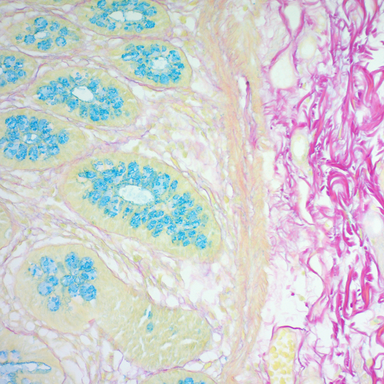 Colloidal Iron Histology Stain Kit, 100 Slides