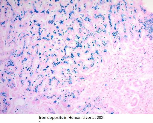 Iron Histology Stain Kit, 100 Slides