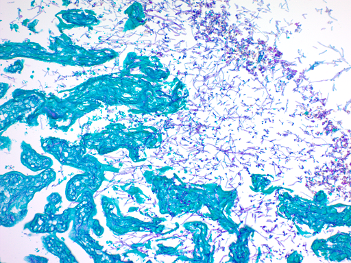 Periodic Acid Schiff (PAS) for Fungus Microbiology/Histology Stain Kit