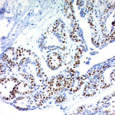 CRF Anti-Polyvalent HRP Polymer (DAB) Lab Pack Stain Kit, 1250 Slides