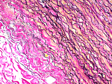 Elastic Histology Stain Kit (Modified Verhoeff's)