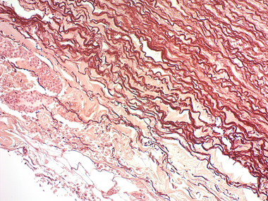 Orcein Microbiology/Histology Stain Kit (For Hepatitis B and Elastic ...