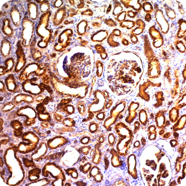 Complement 4d (C4d) (Acute Humoral Rejection Marker); Clone C4D204 ...