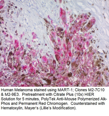 MART-1 / Melan-A /mLANA (Melanoma Marker); Clone M2-7C10 & M2-9E3 ...