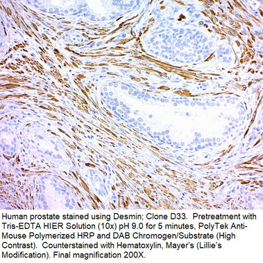 Desmin (Muscle Cell Marker); Clone D33 (Concentrate), 1mL