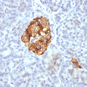 Chromogranin A / CHGA (Neuroendocrine Marker); Clones CGA/413 & CHGA ...