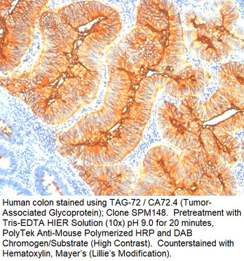 TAG-72 / CA72.4 (Tumor-Associated Glycoprotein); Clone SPM148 ...