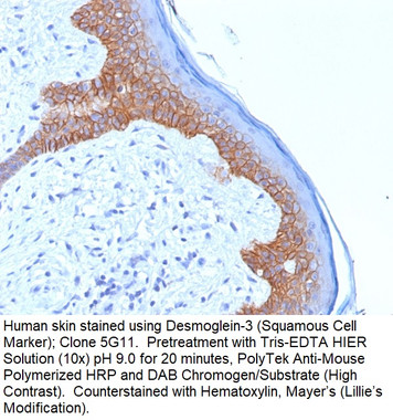 Desmoglein-3 (Squamous Cell Marker); Clone 5G11 (Concentrate), 1mL