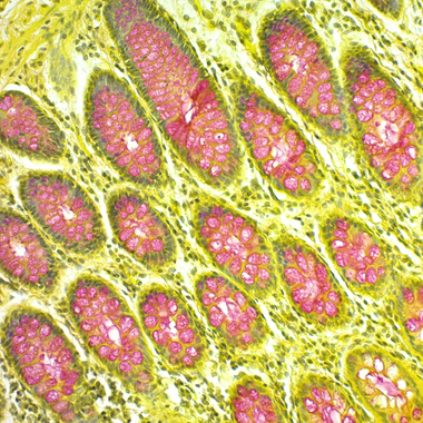Mucicarmine Microbiology/Histology Stain Kit (Modified Southgate's)