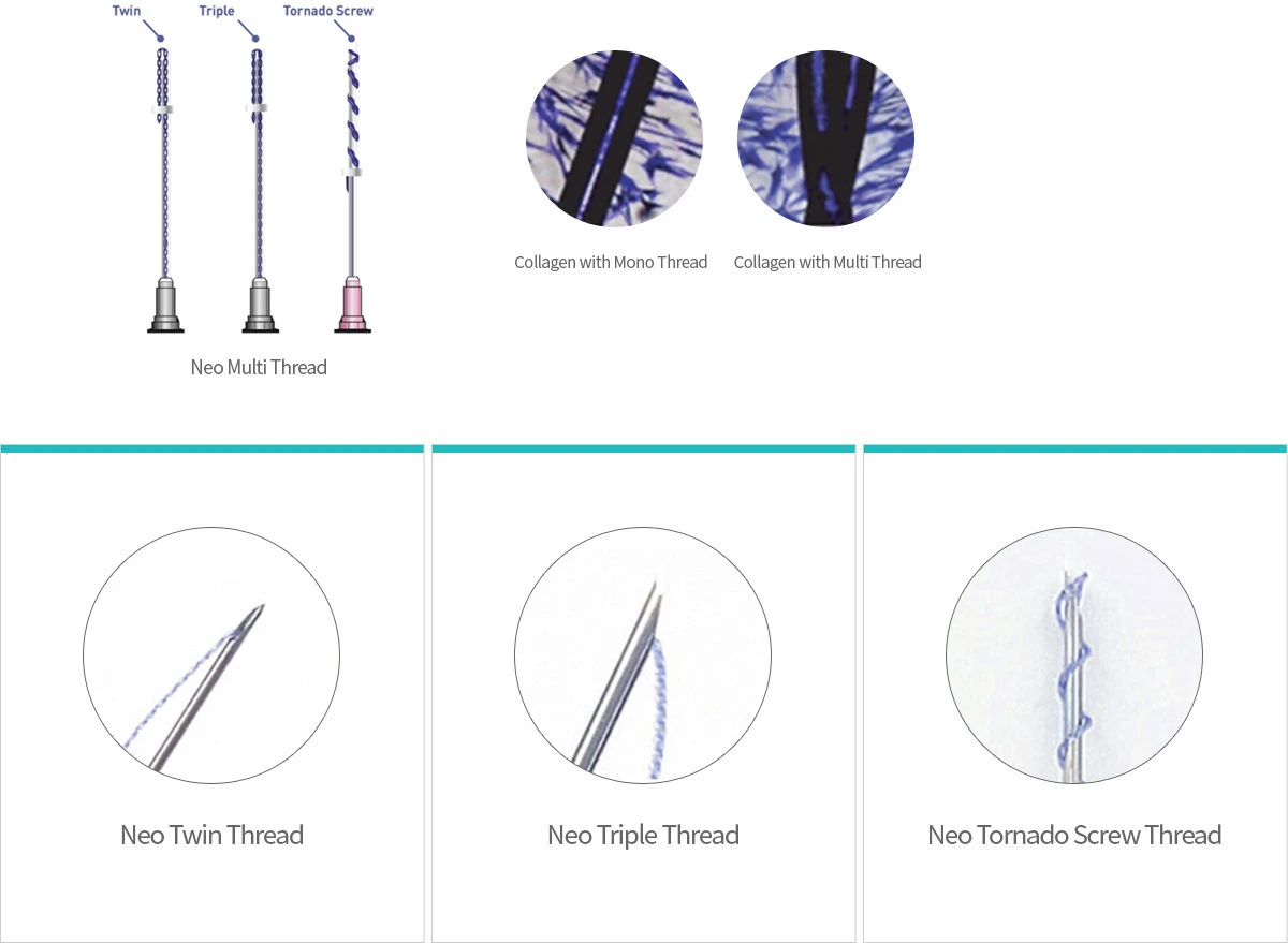 NeoGenesis PDO Tornado Screw 26G, 38mm
