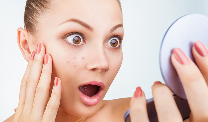 7 Beginner Tips for Preventing Acne Naturally - GetGlowing Skincare