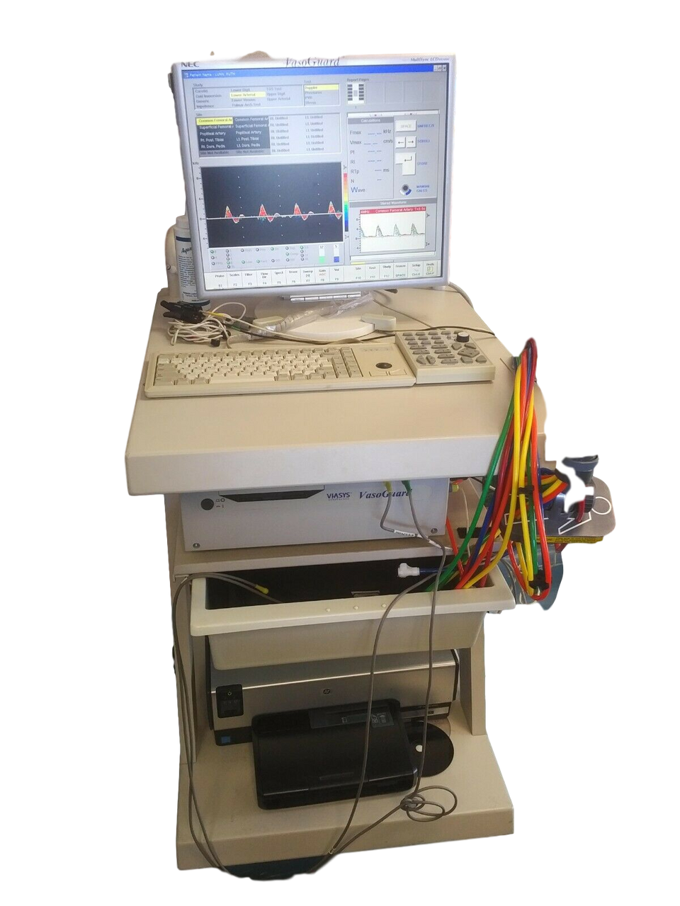 Viasys Vasoguard Vascular Ultrasound on Cart - SPW Industrial