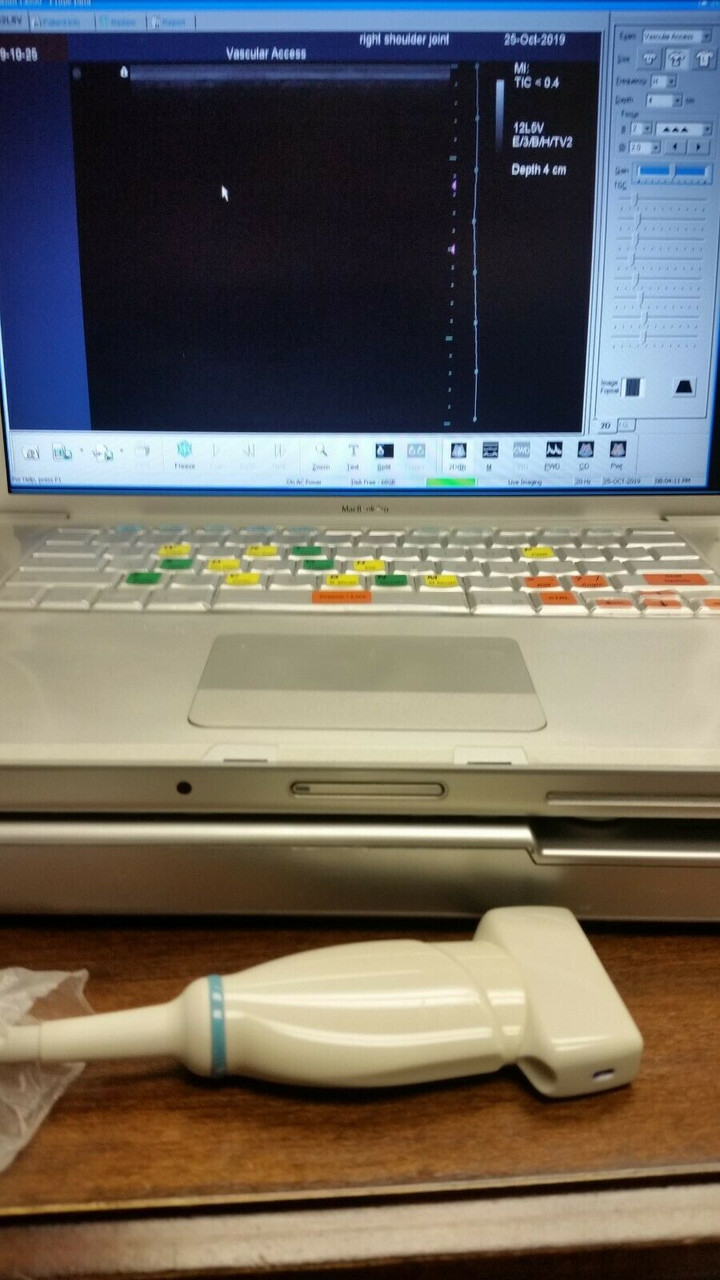 Terason Ultrasound System,