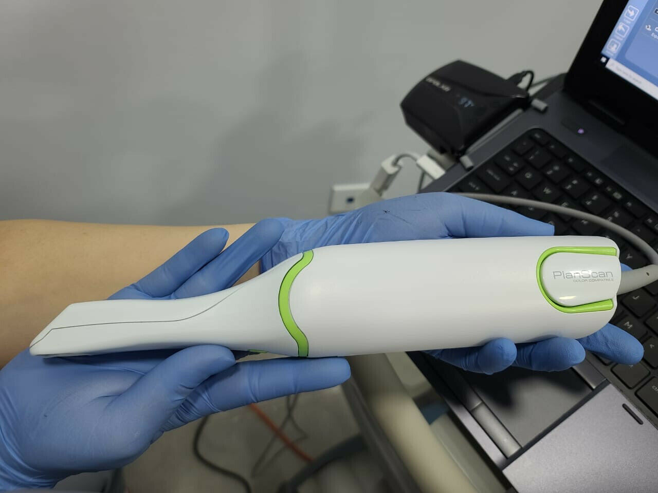 Planmeca Planscan IntraOral Scanner (SOFTWARE AND INCLUDED, DASH ...