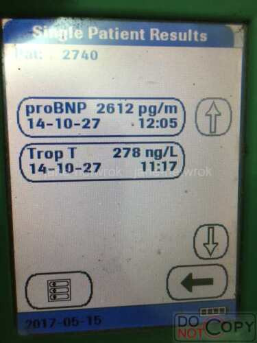 1Pc 100% Tested Cobas H 232 Cardiac - SPW Industrial