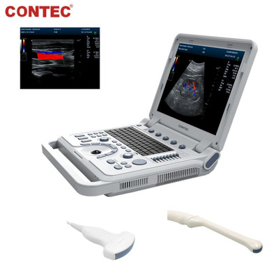 CMS1700A Color Doppler Portable Ultrasound Scanner Machine Convex ...