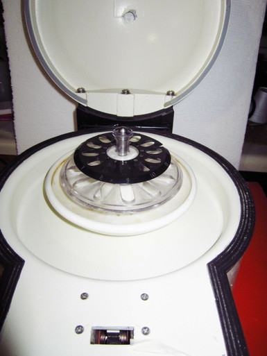 Buy -CLAY ADAMS SERO-FUGE 2001 Centrifuge