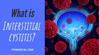 A Brief Guide to Interstitial Cystitis - TYE Medical